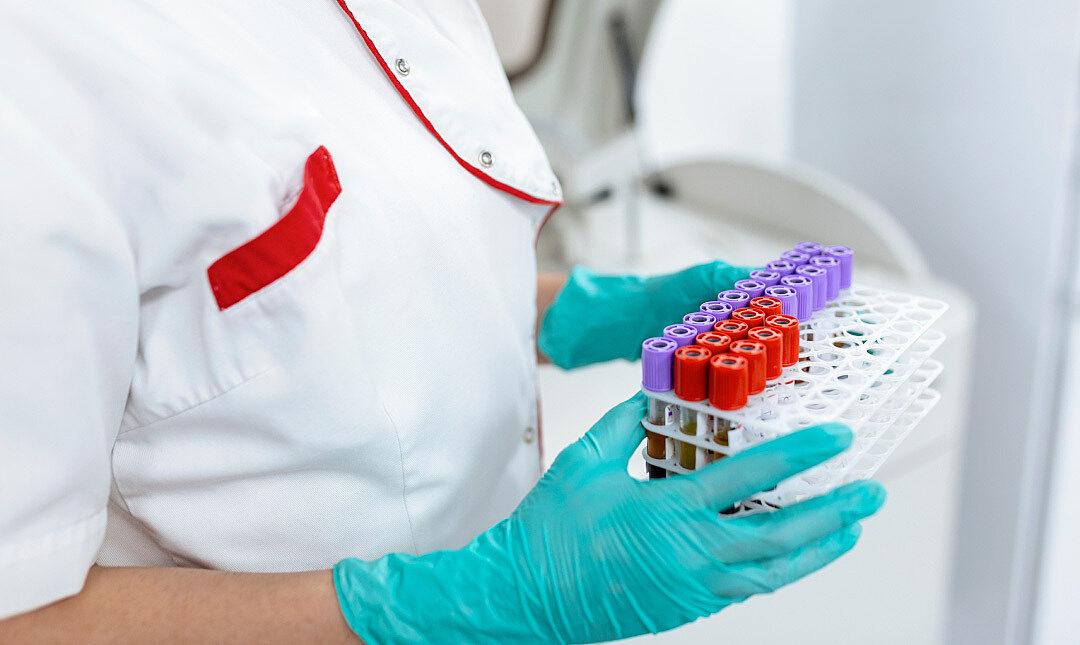 Specimen Tracking Technology Guide: From Barcodes to Real-Time…